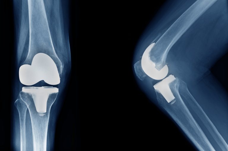 Precision Orthopaedic Specialties - Sports Medicine - Chardon, Ohio