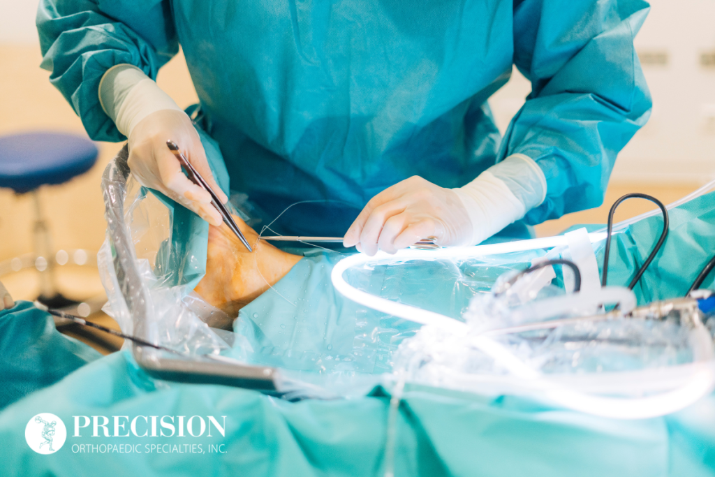 Ankle Arthroscopy - Precision Orthopaedic Specialities