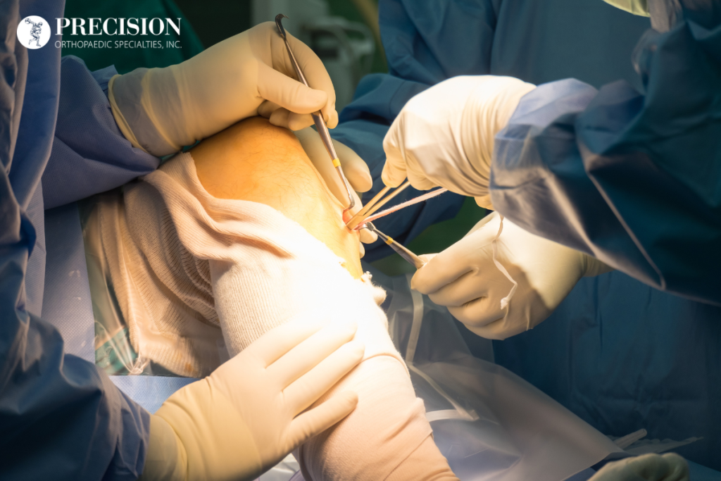 Knee Ligament Repair - Ohio - Precision Orthopaedic Specialties