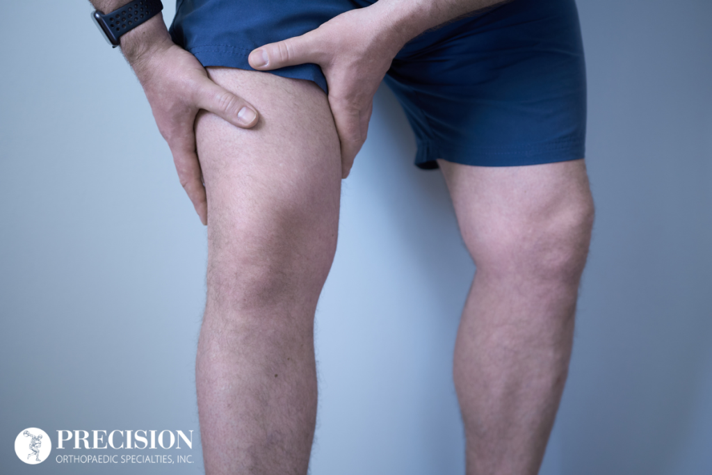 Quadriceps Strain - Ohio - Precision Orthopaedic Specialties