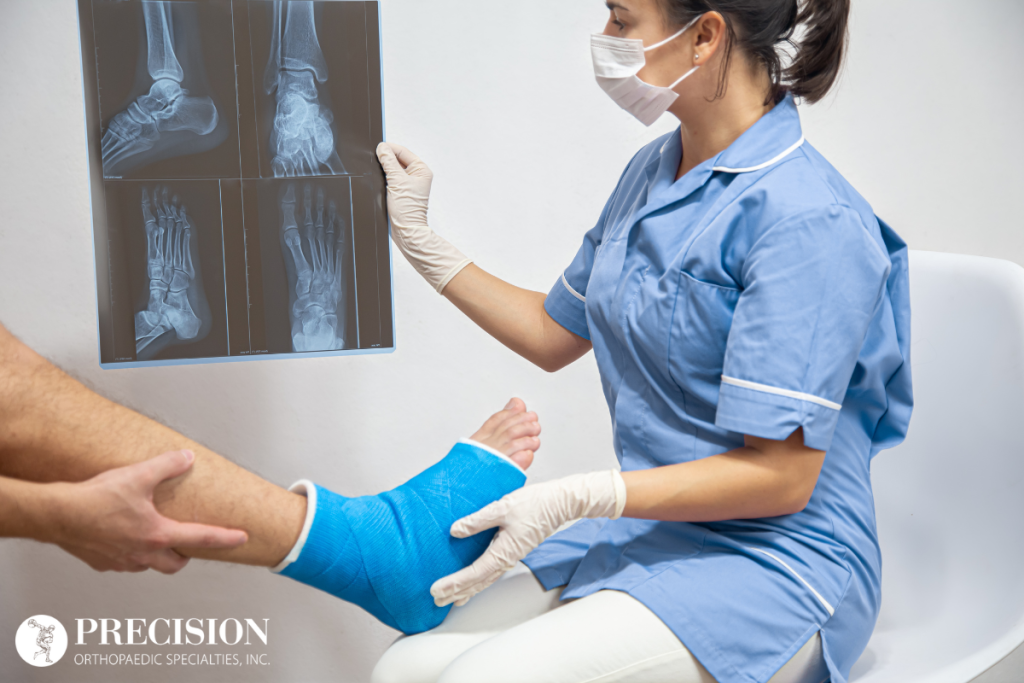 Bone Fracture - Ohio - Precision Orthopaedic Specialties